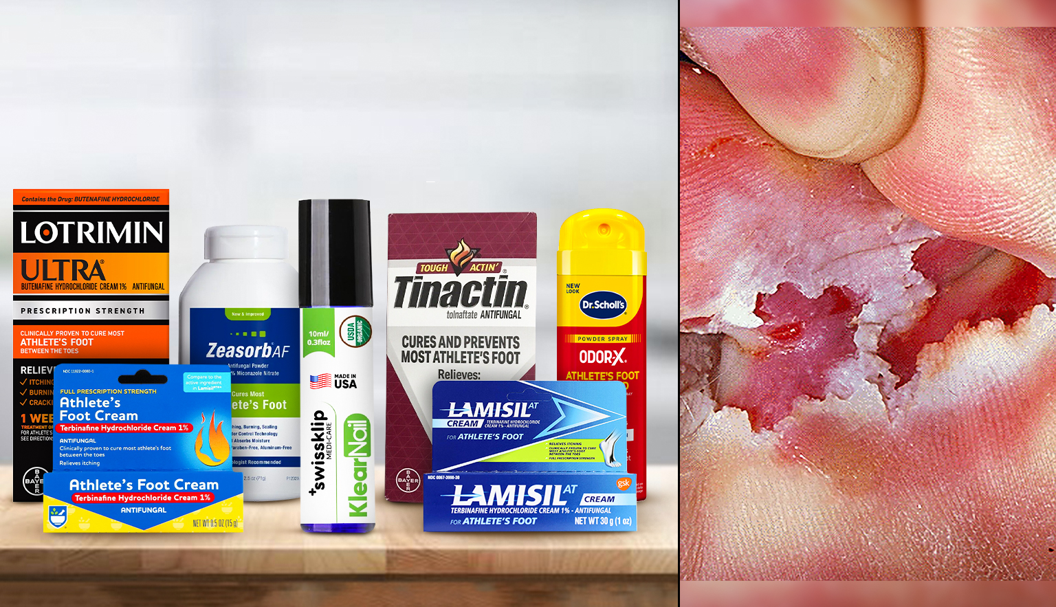 THE 7 BEST ATHLETE'S FOOT SOLUTIONS IN 2025